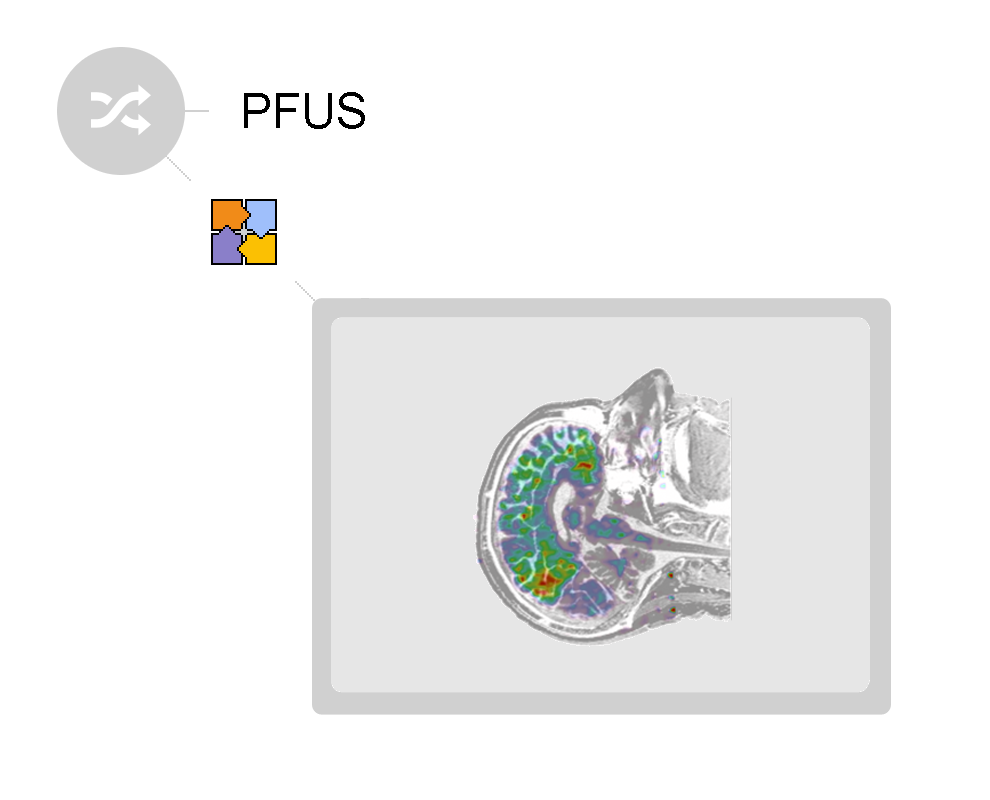 Image Processing – PMOD Technologies LLC